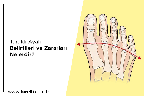 Topuk Dikeni Belirtileri Nelerdir? Nasıl Anlaşılır? | Forelli
